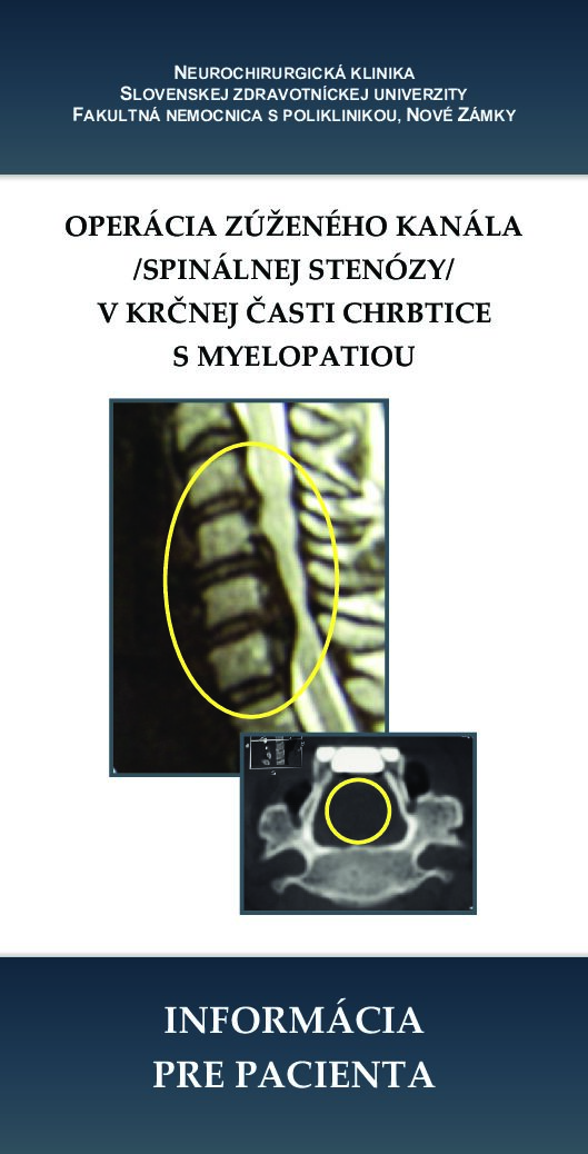 Neurochirurgická klinika - pre pacientov - Fakultná nemocnica s ...
